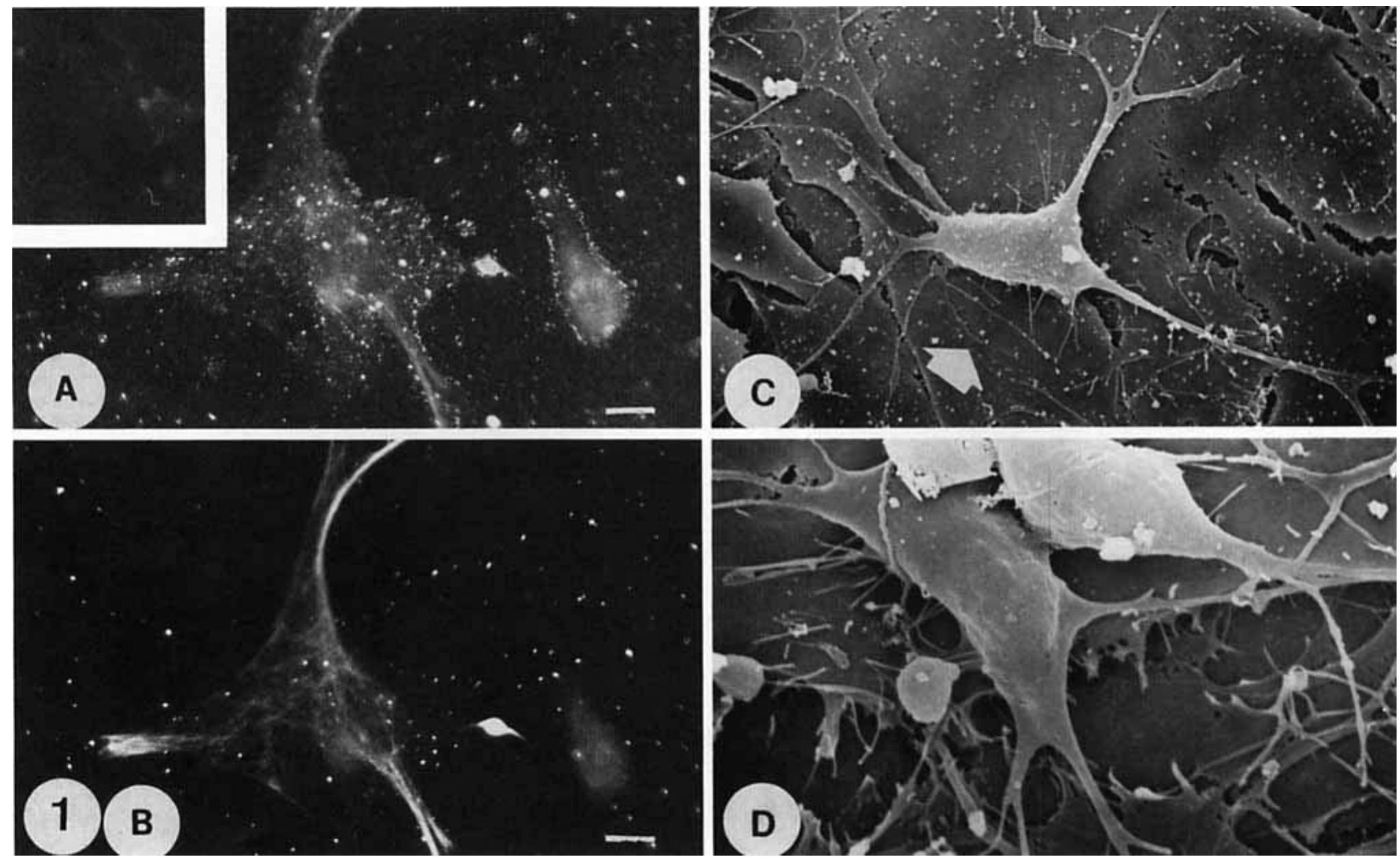 Immunocytochemical staining of human fetal astro- cytes for