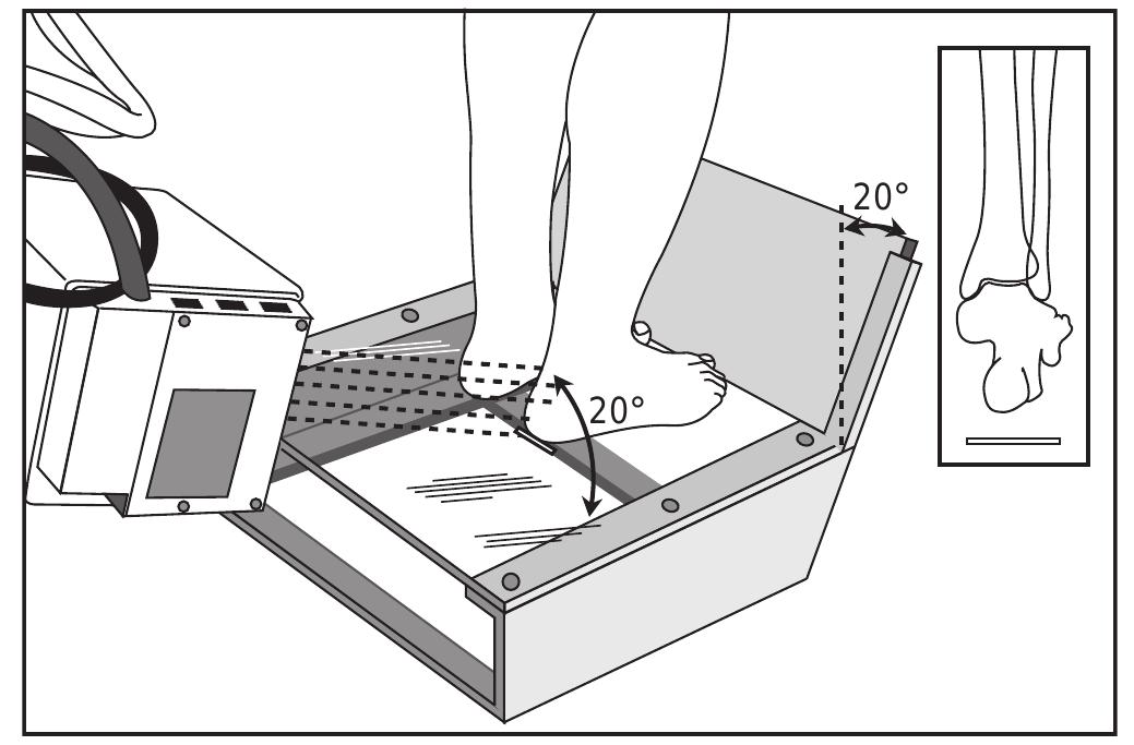 Hindfoot alignment (saltzman) view is obtained with the