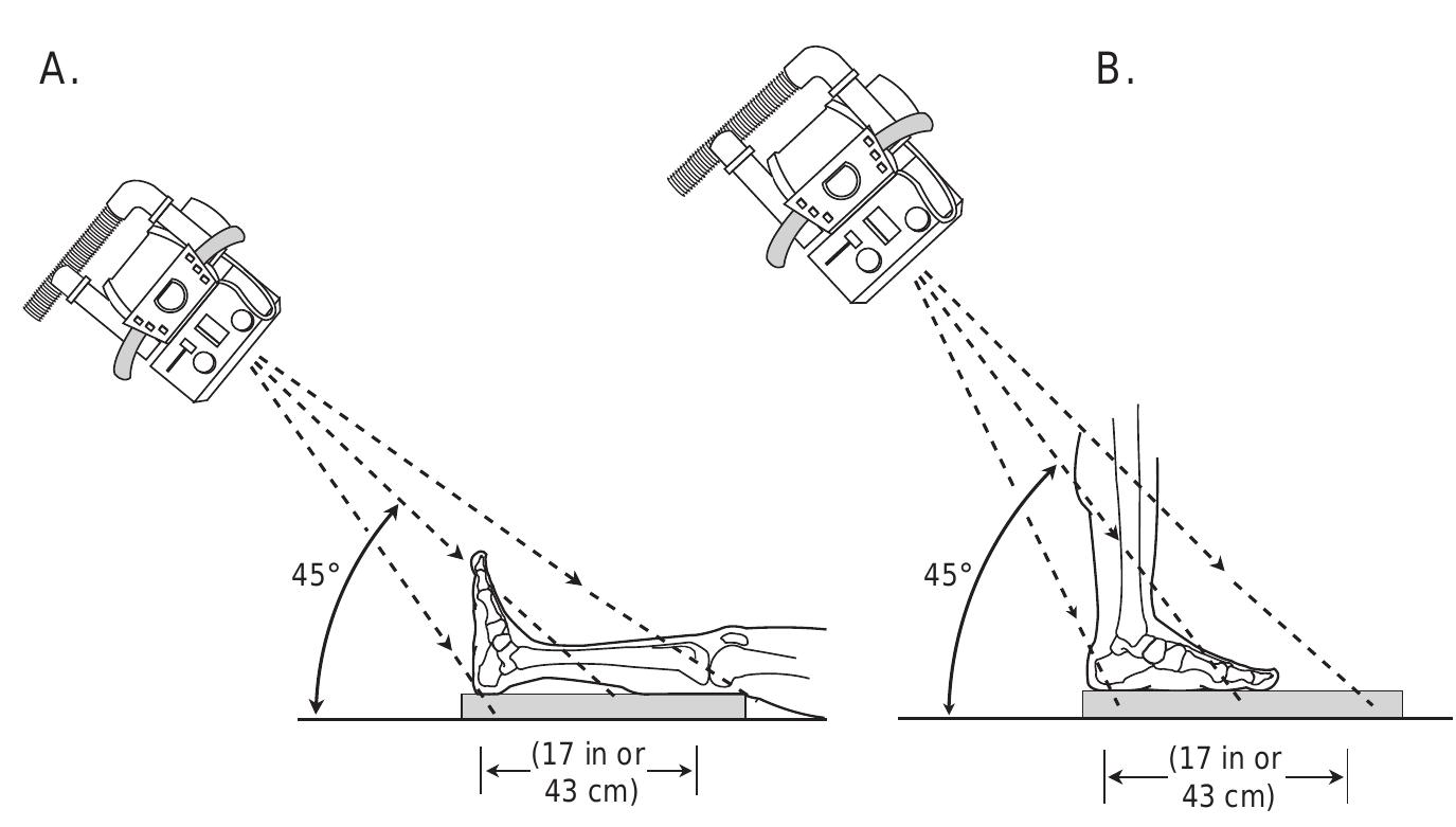(a) long calcaneal axial view radiograph can be obtained