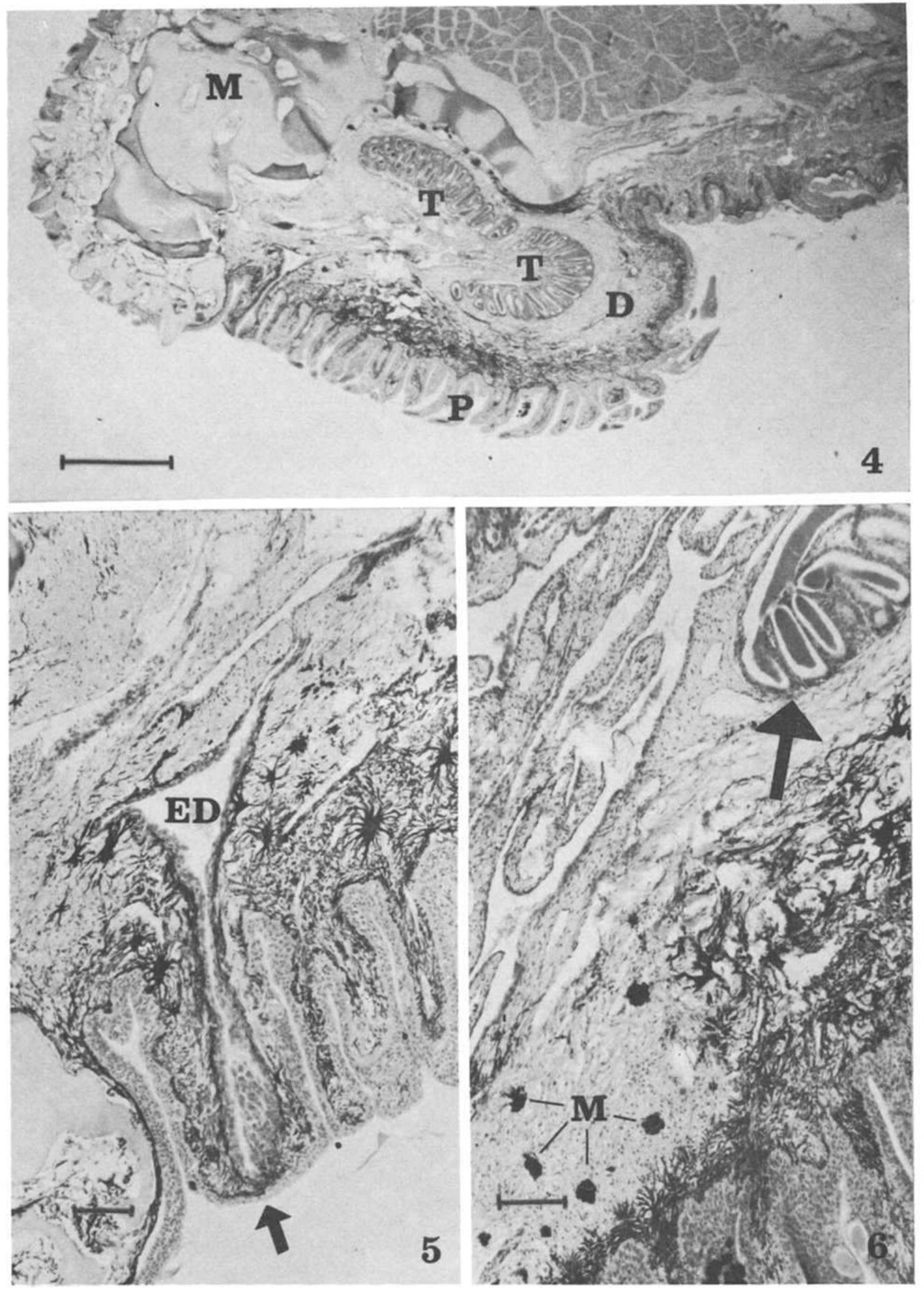 A sagittal section of the lower jaw reveals the