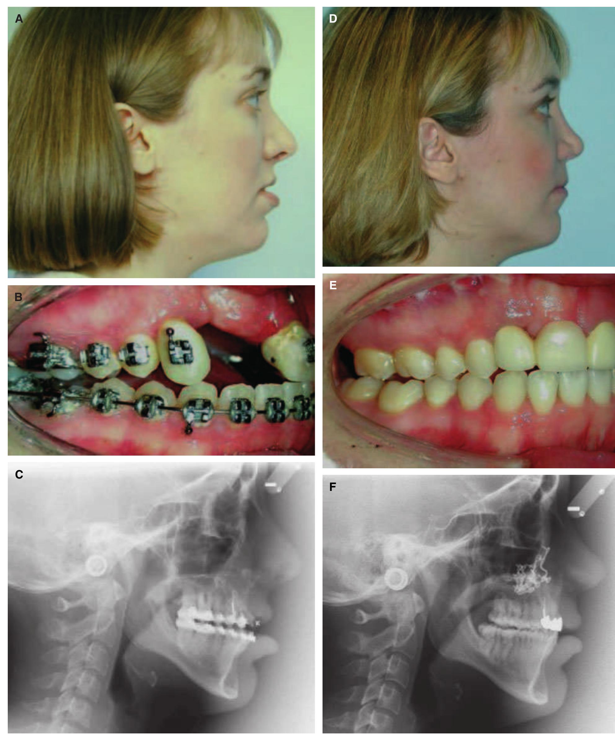 Facial and intra-oral photographs and cephalometric