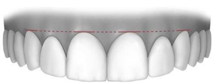 (PDF) Smile Design