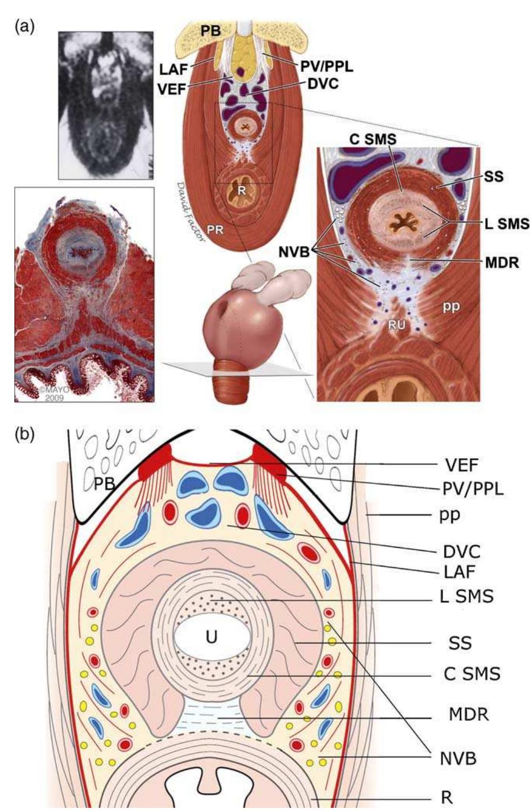 - axial section of sphincteric urethra: (a) anatomic