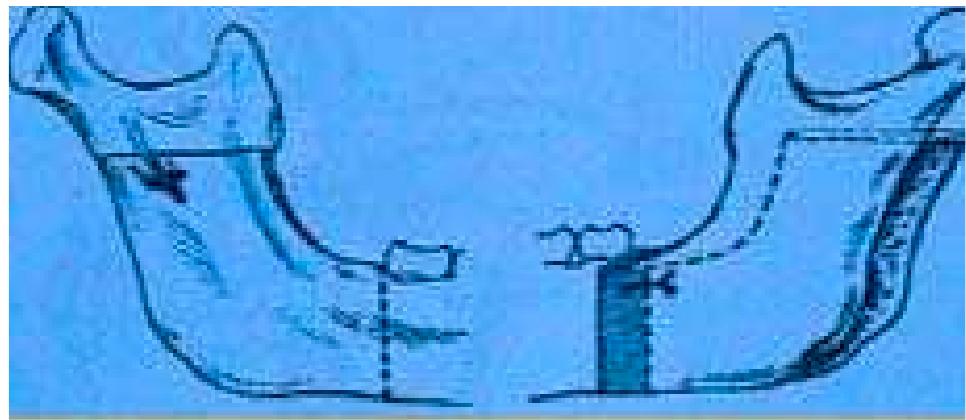 Ura 2. esquema tomado del articulo original, que representa