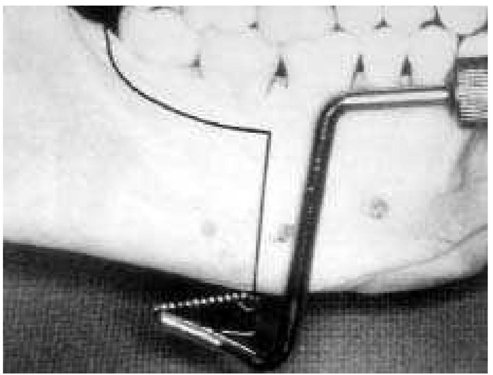 Ura 5. esquema tomado del articulo original, que representa