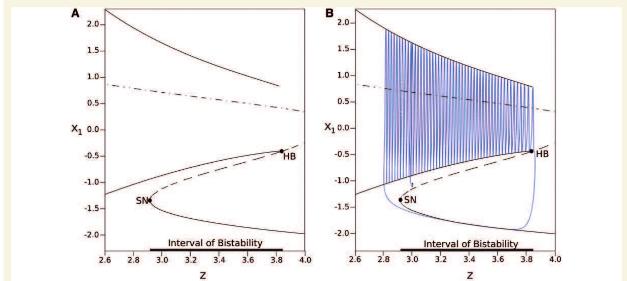 Bifurcation diagram of the epileptor. (a) the set of fixed