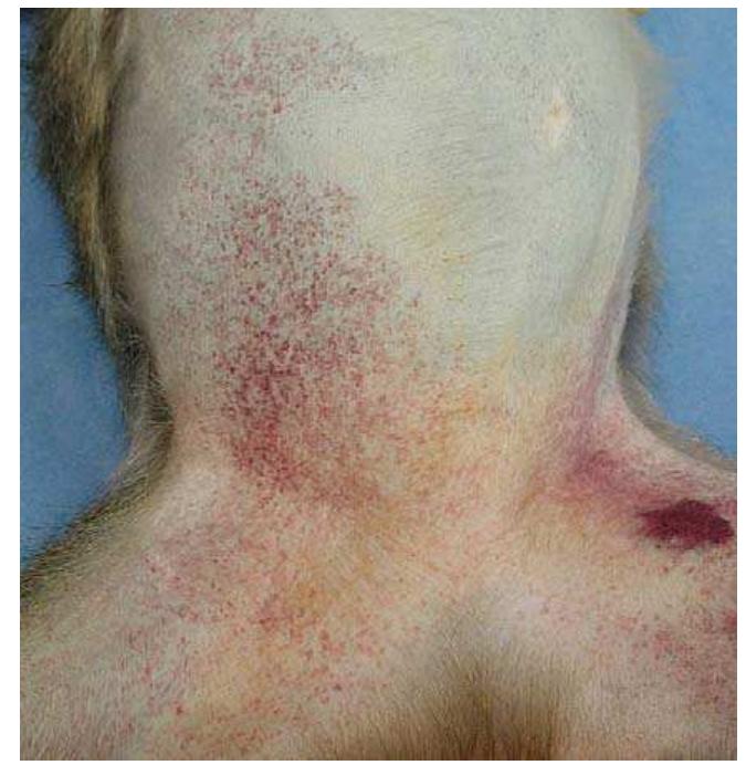 Characteristic petechial rash of the abdomen and inguinal