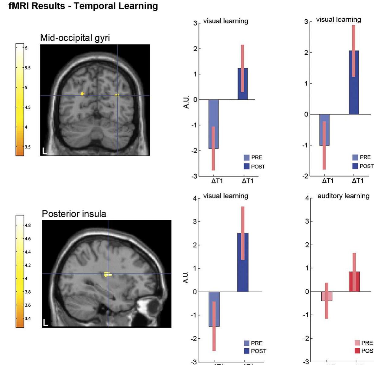 Timing-related plasticity in the human brain. (a, b) brain