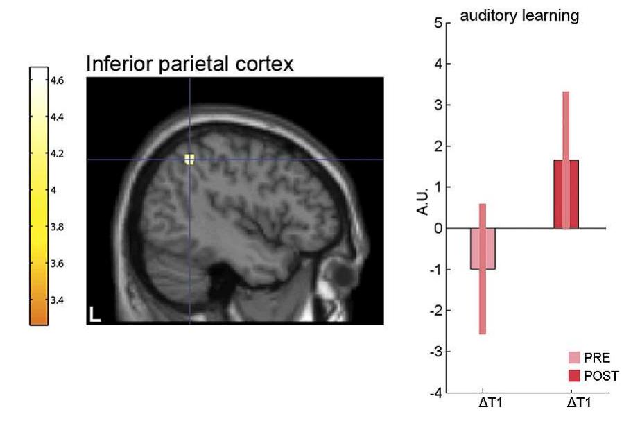 Figure 6 - Temporal Perceptual Learning