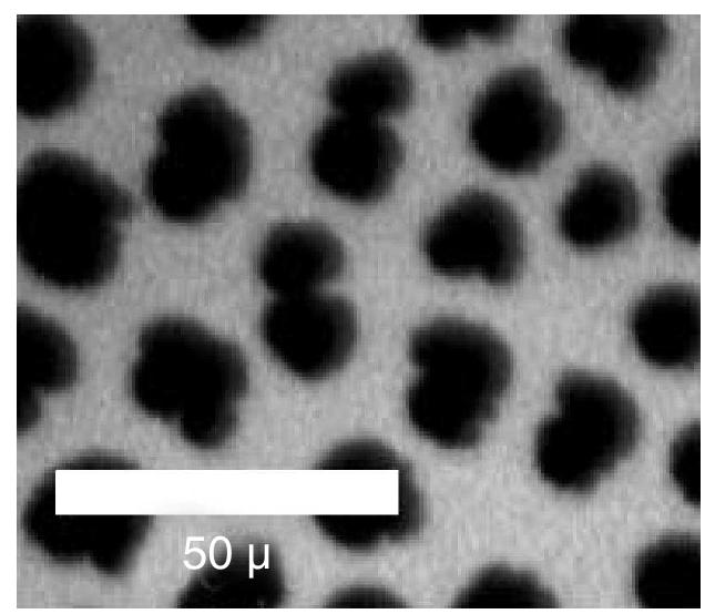 Fluorescence micrograph of a model lung surfactant monolayer