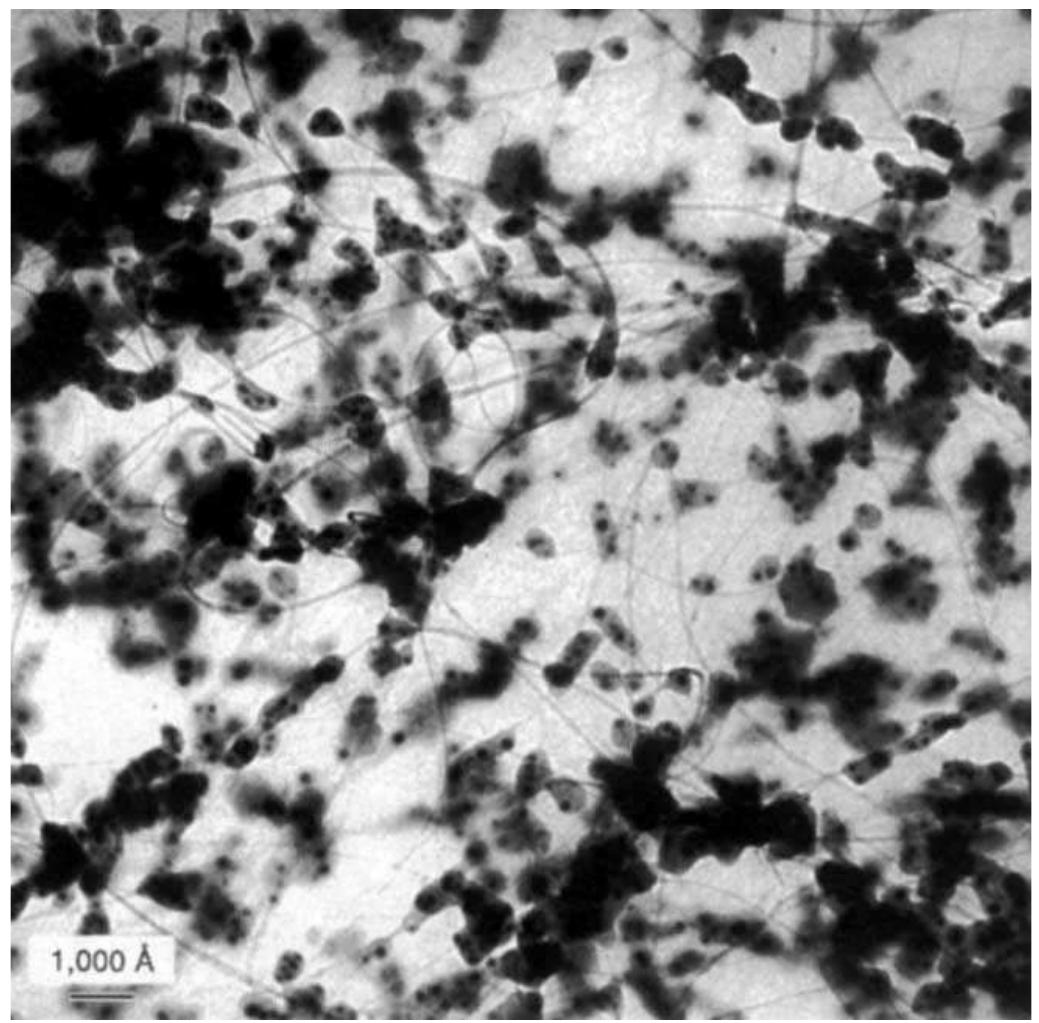 Transmission electron micrograph of web-like material