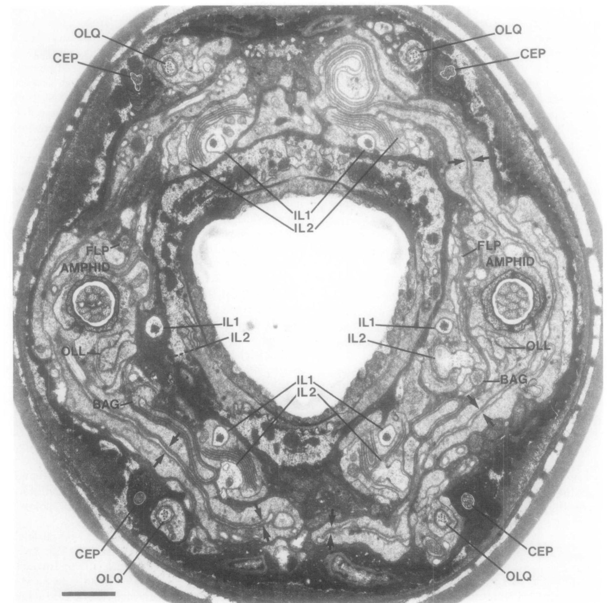 Fic. 1. anterior sensilla in wild-type hermaphrodite.