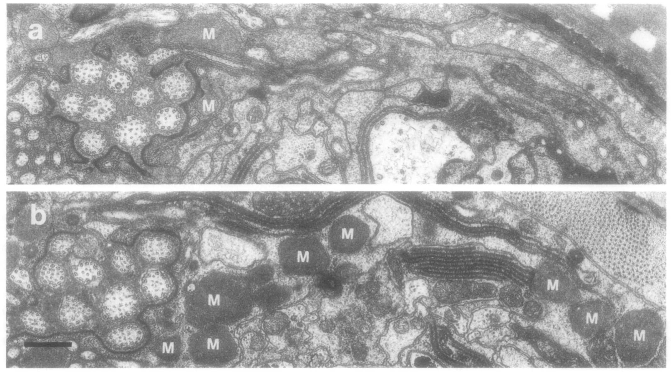 Fic. 22. matrix in amphid sheath cells of wild-type and