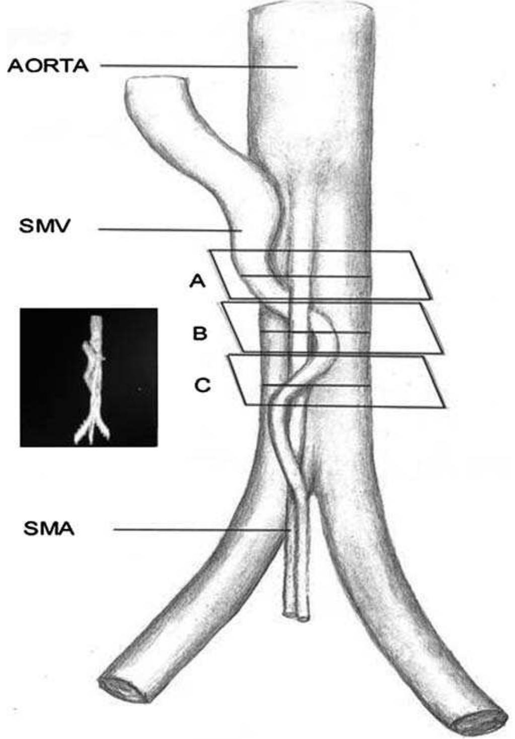 Sketch adapted from 3d ct reconstruction. see fig. 4 fot