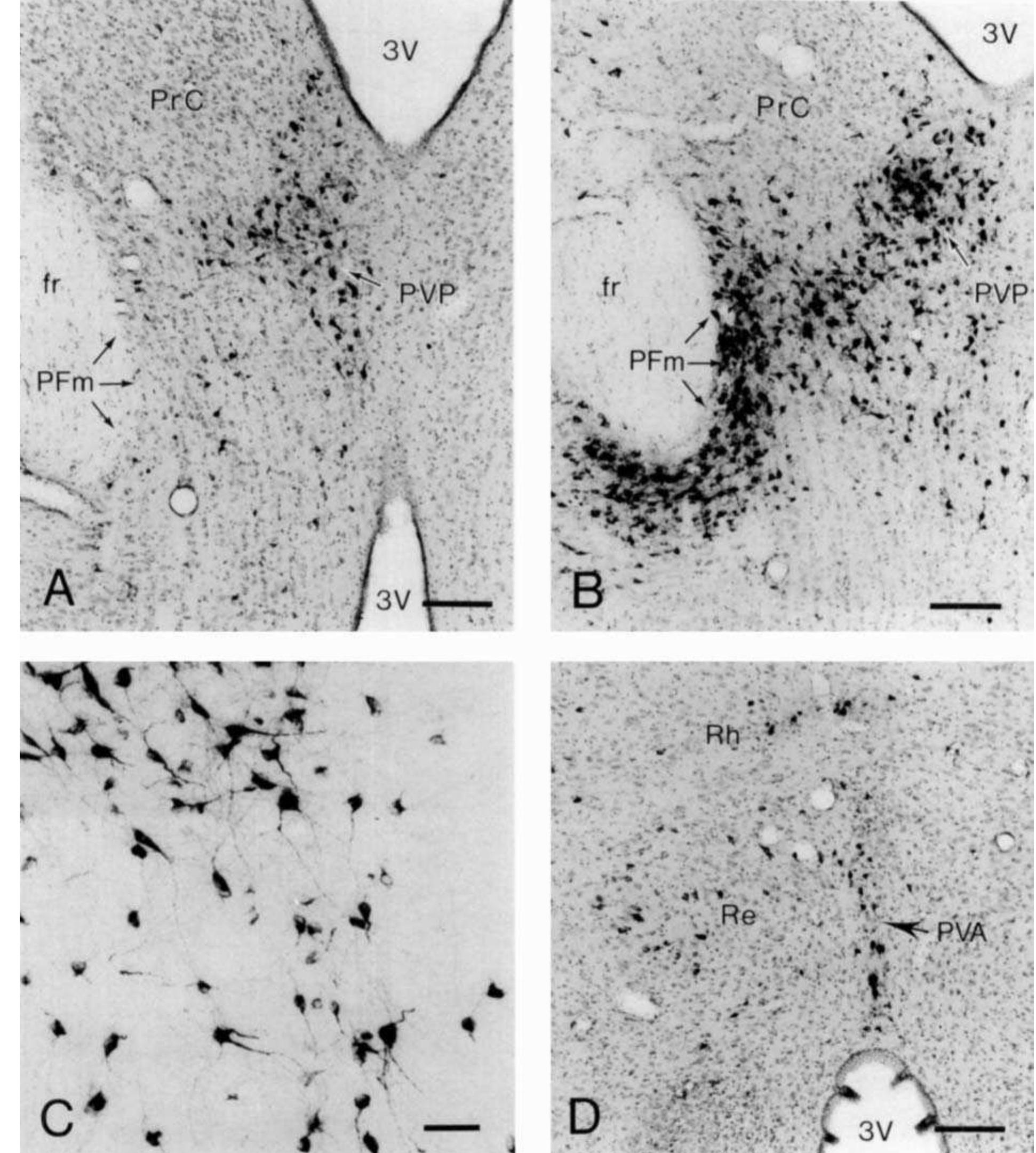 Tricular nucleus and the medial part of the parafascicular