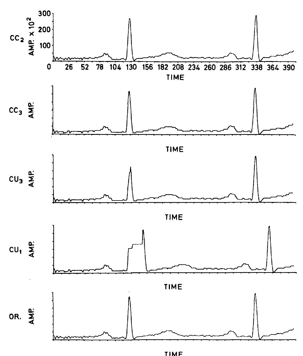 Examples of reconstructed e.c.g. analogue waveforms. cu
