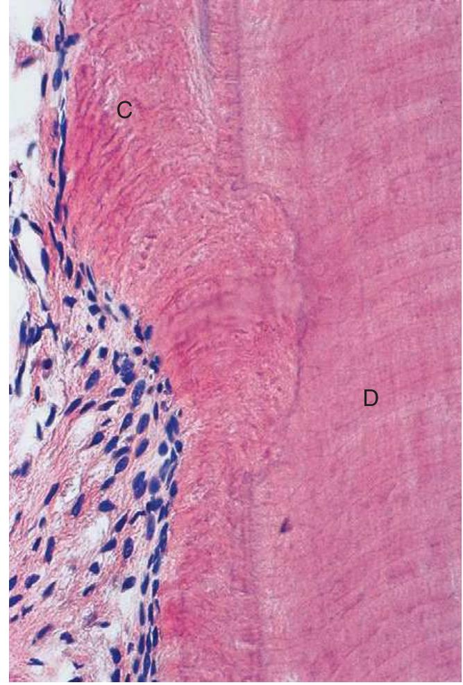 6 healed surface resorption. the slide depicts a healed root