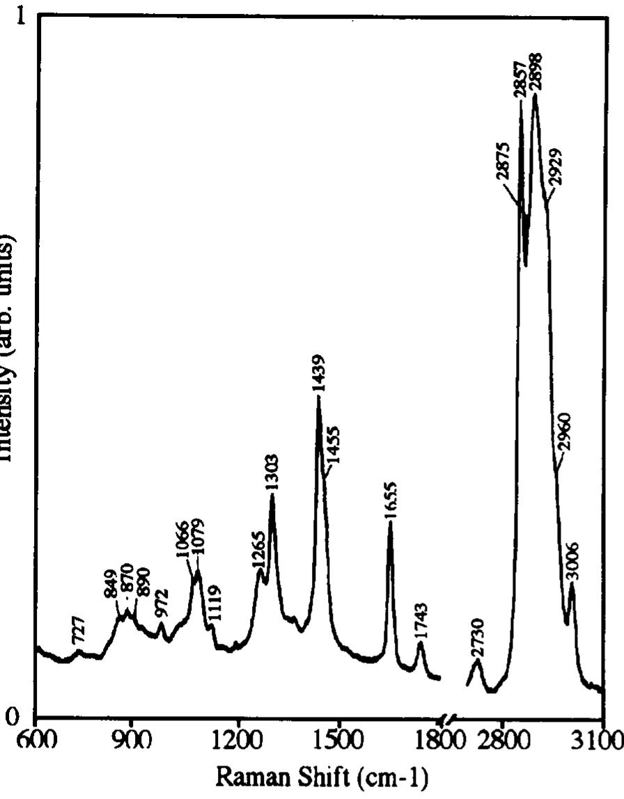 Near-ir raman spectrum of normal breast specimen excited by