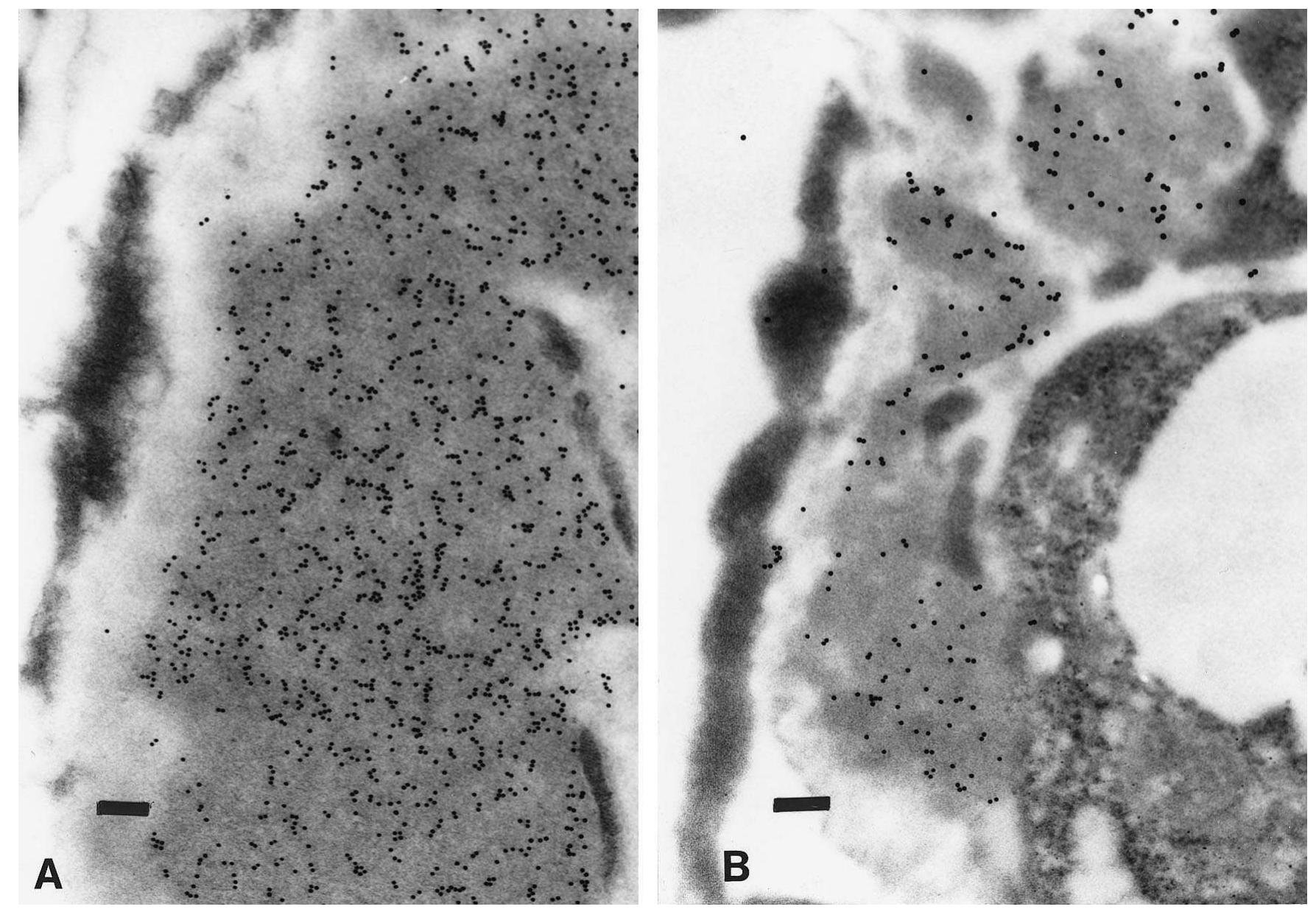 Glomerular deposits in iga nephropathy in lr white resin.