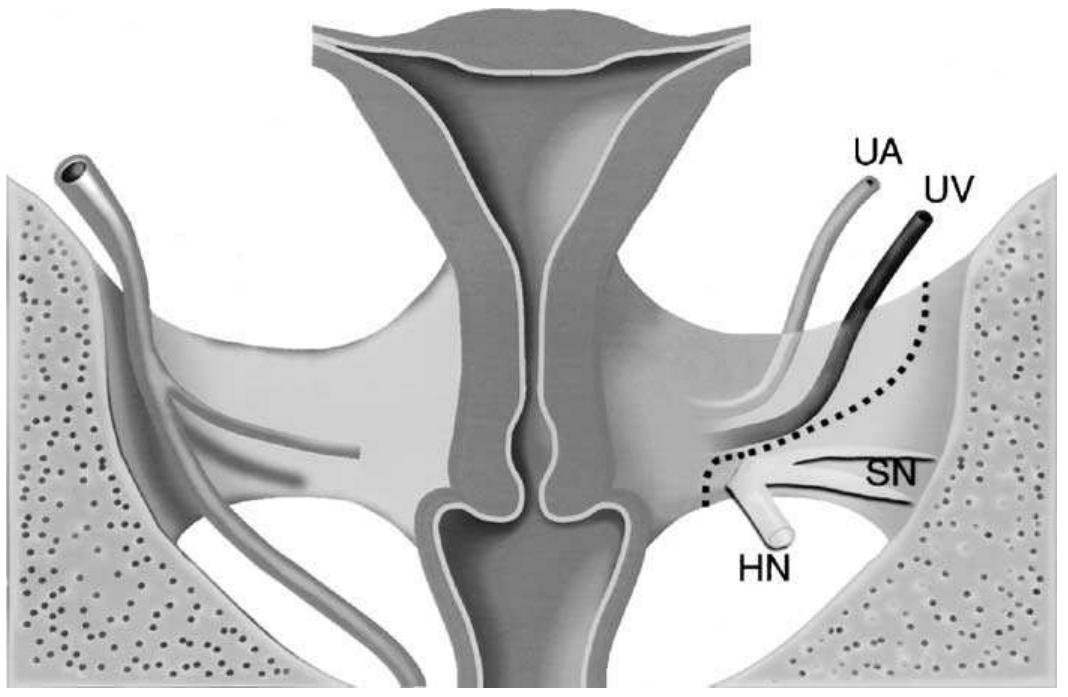 Diagram of the pelvic autonomic nerves in the parametrium or