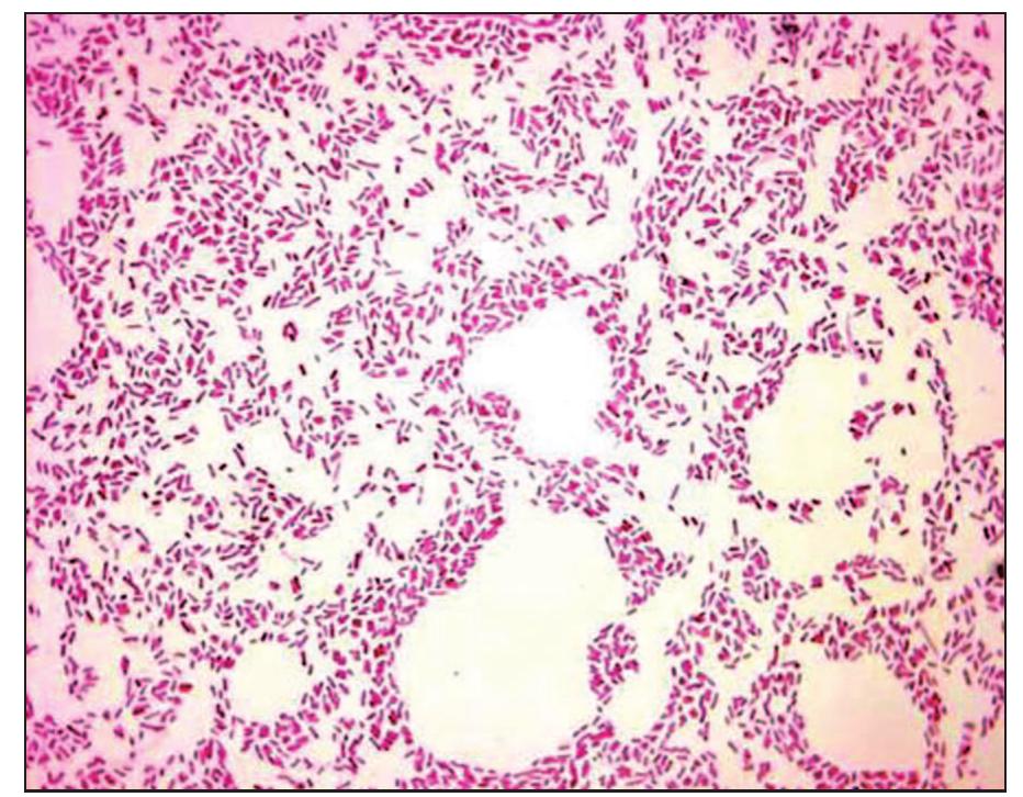 Figure 5 - Laboratory perspective of gram staining and its