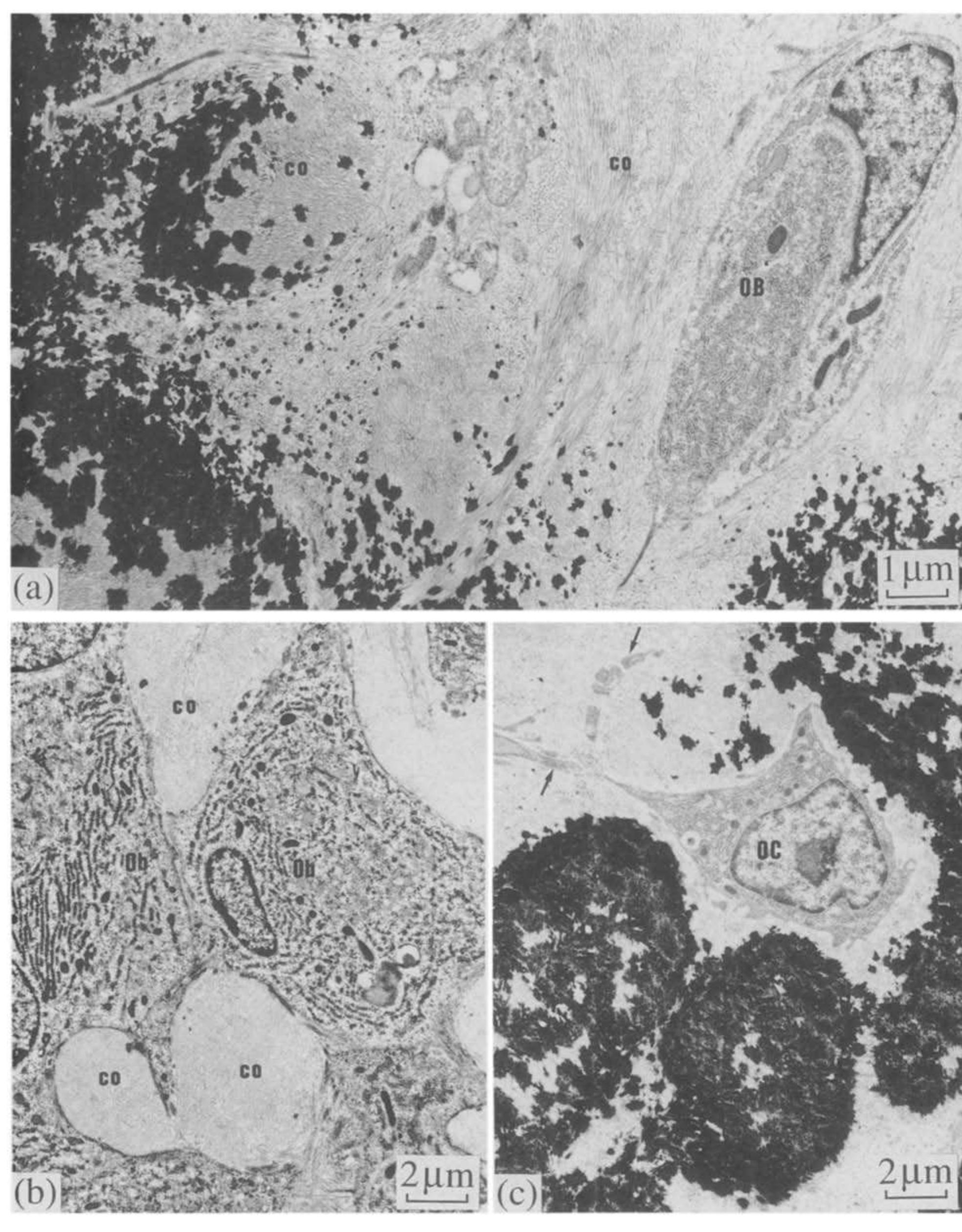 Electron micrographs taken 7 days after insertion. solitary