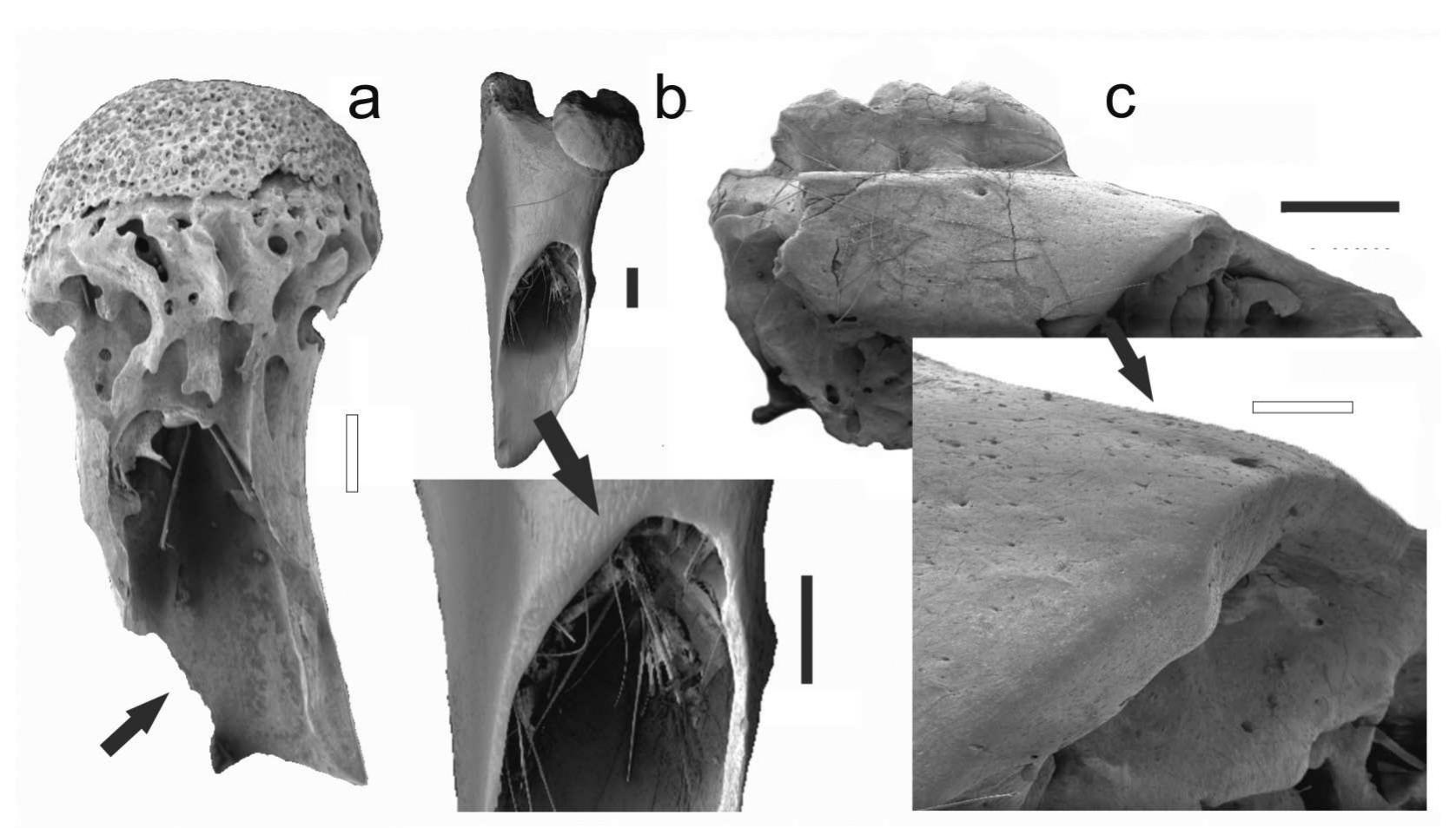 Scanning electron microscope pictures showing broken bones