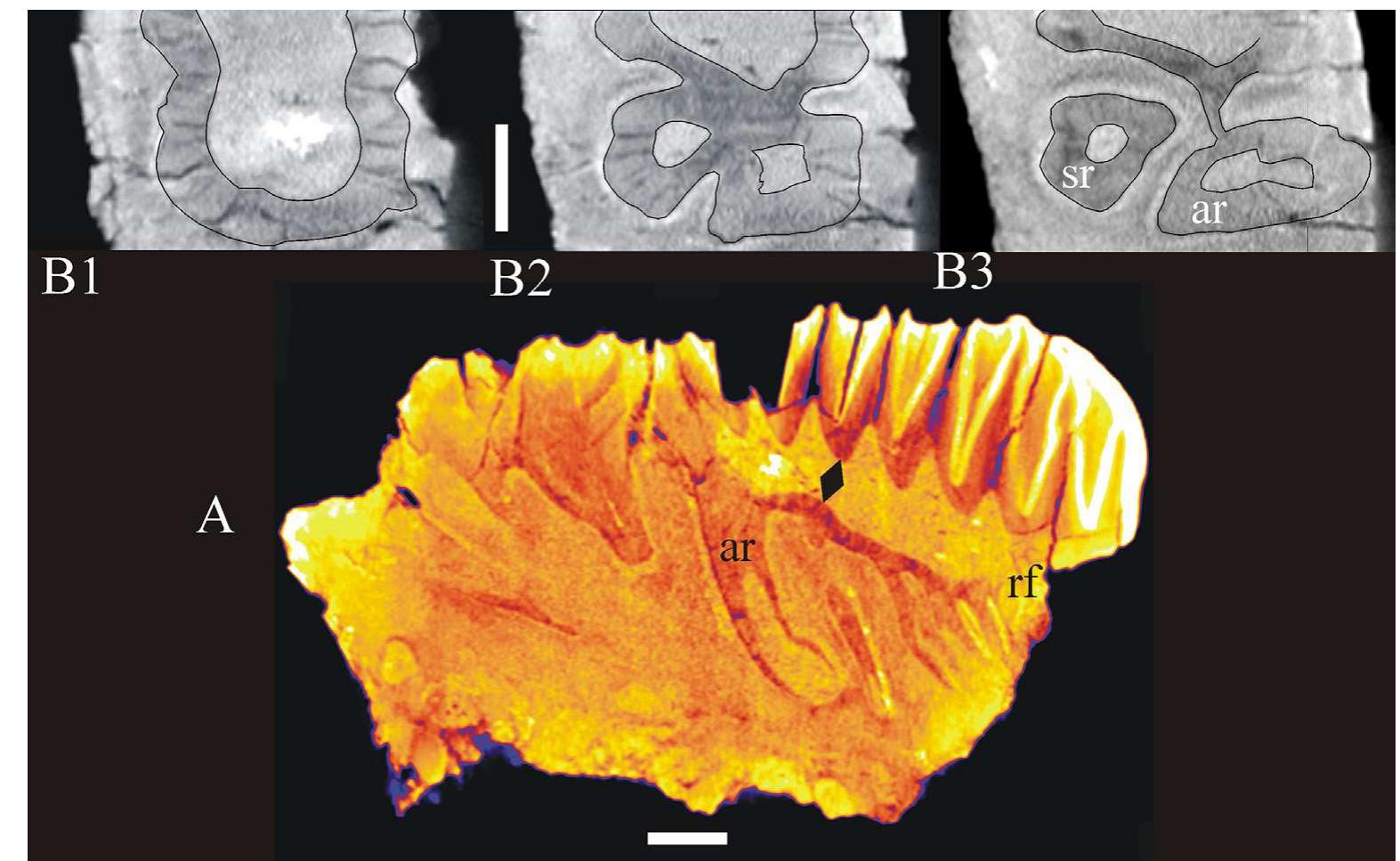 Para-sagittal vertical ct scan of the maxilla lgput mp-04