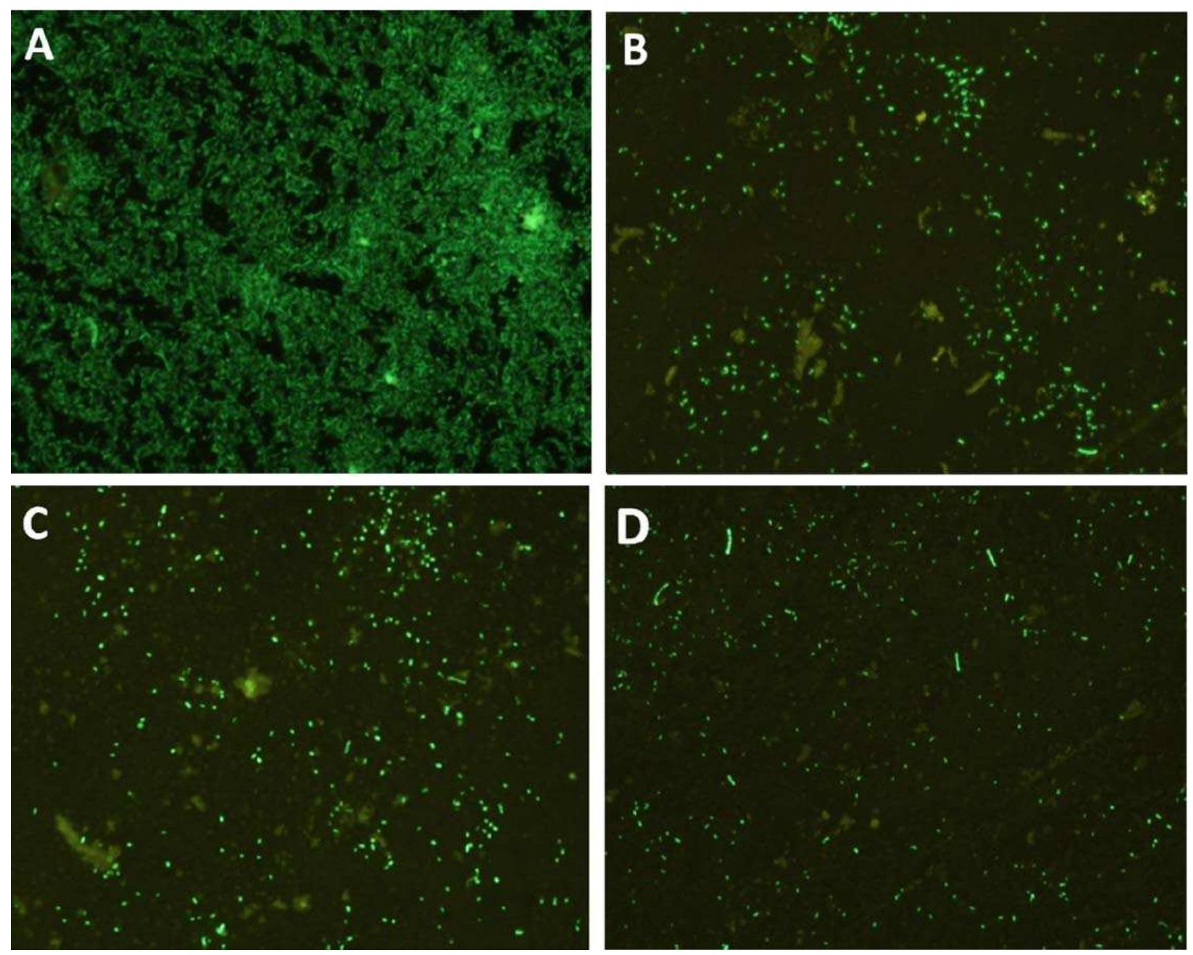 Fluorescence micrographic images of gfp e. coli treated with