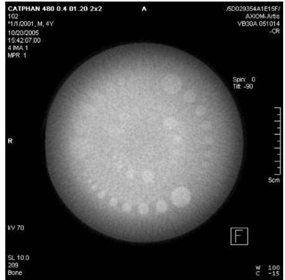 5. c-arm ct reconstruction of the ctp515 catphan image