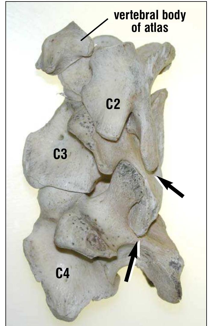 (PDF) Anatomy of Sea Turtles