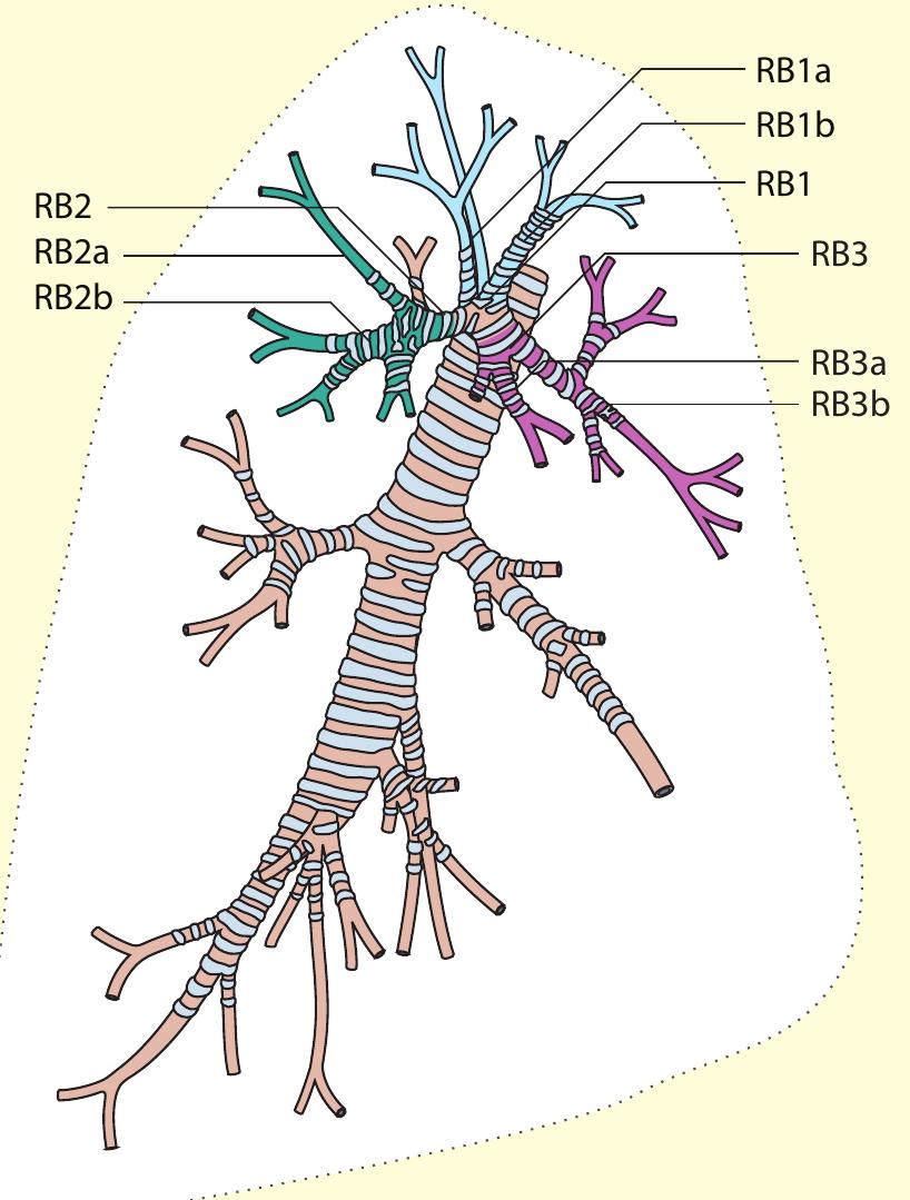 Figure 18 - from Atlas of Flexible Bronchoscopy