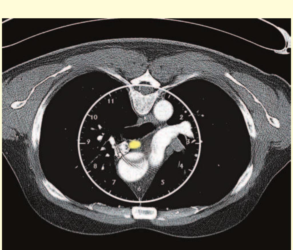 4|« cross-sectional ct scan flipped on the horizontal