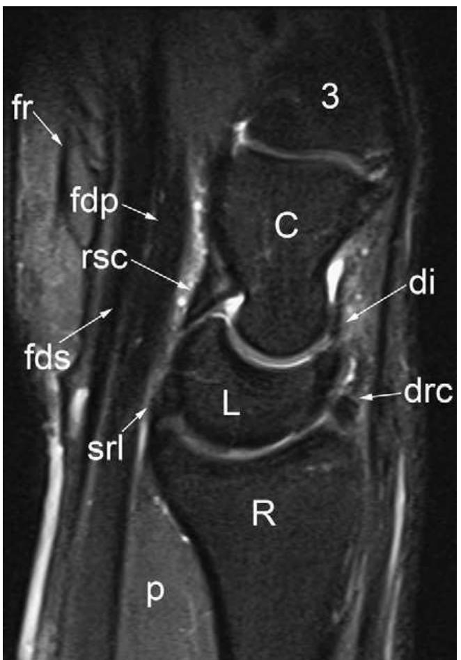 Normal osseous anatomy. sagittal t2-weighted image with fat