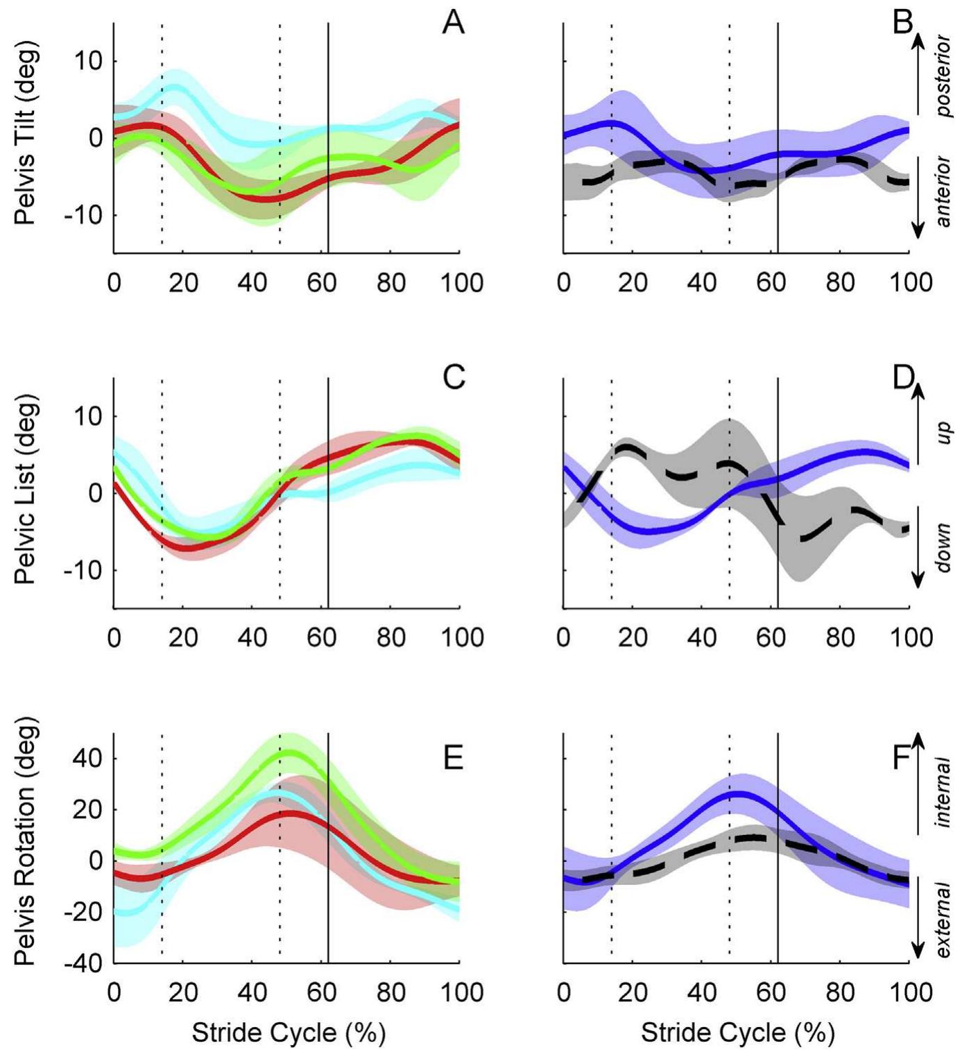 The pelvis (a—b) tilt, (c—d) list and (e—f) rotation angles