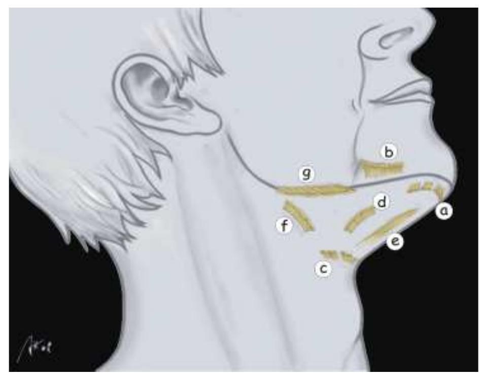 Skin ligaments: (a) submental ligaments, (b) man- dibular