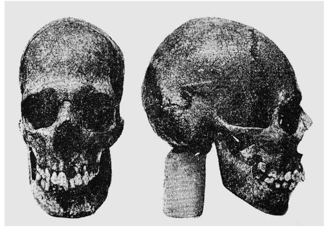 Frontal and right lateral views of the minoan microcephalic.
