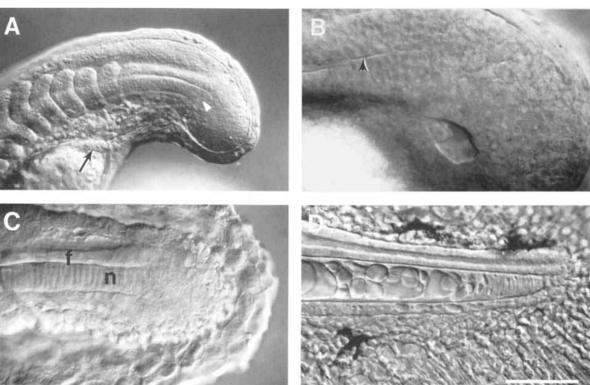 (PDF) Stages of embryonic development of the zebrafish