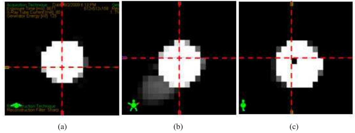 Fic. 4. axial (a), coronal (b), and sagittal (c) cbct images