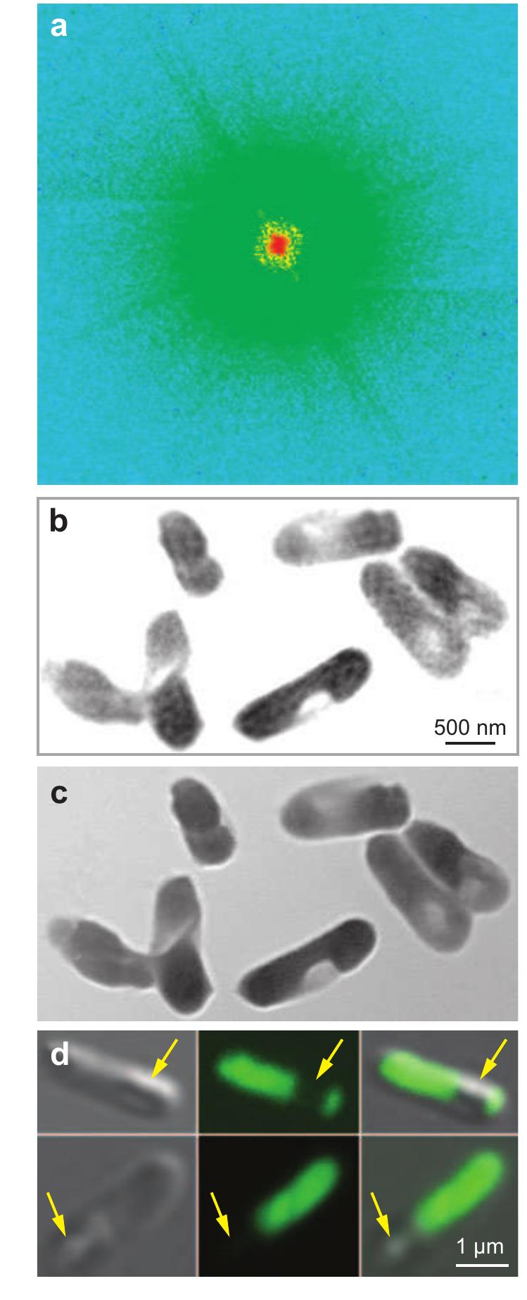 (a) oversampled diffraction pattern from e. coli bacteria.