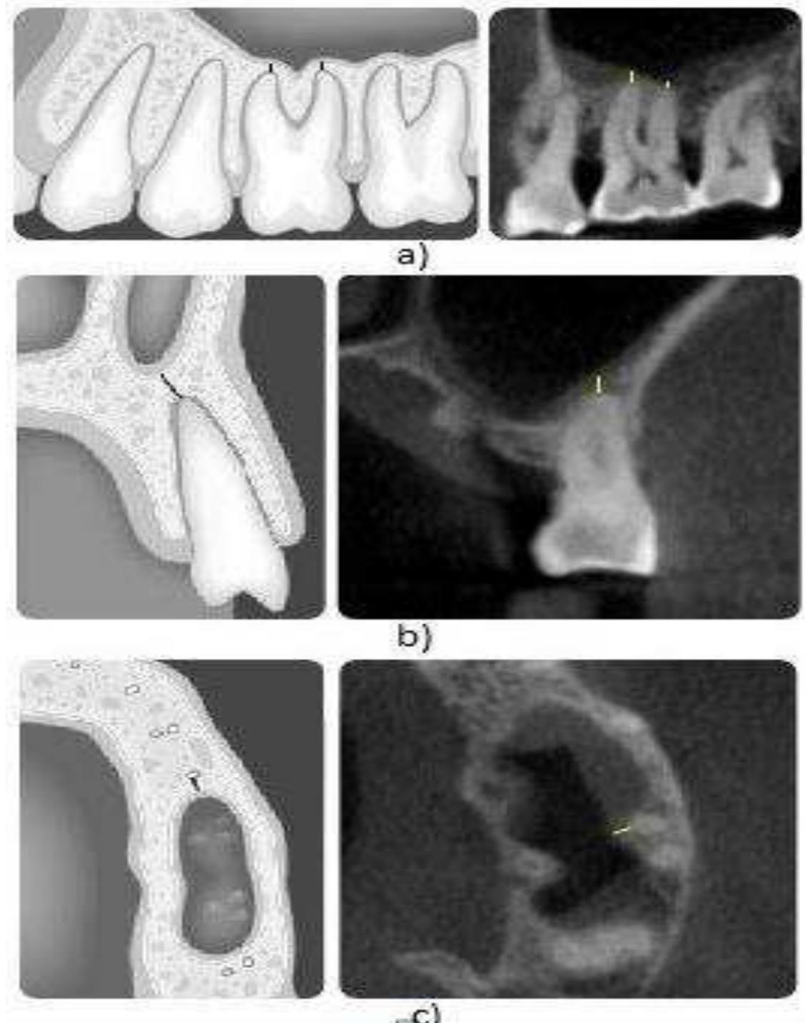 A schematic illustration and c bct view showing the shortest