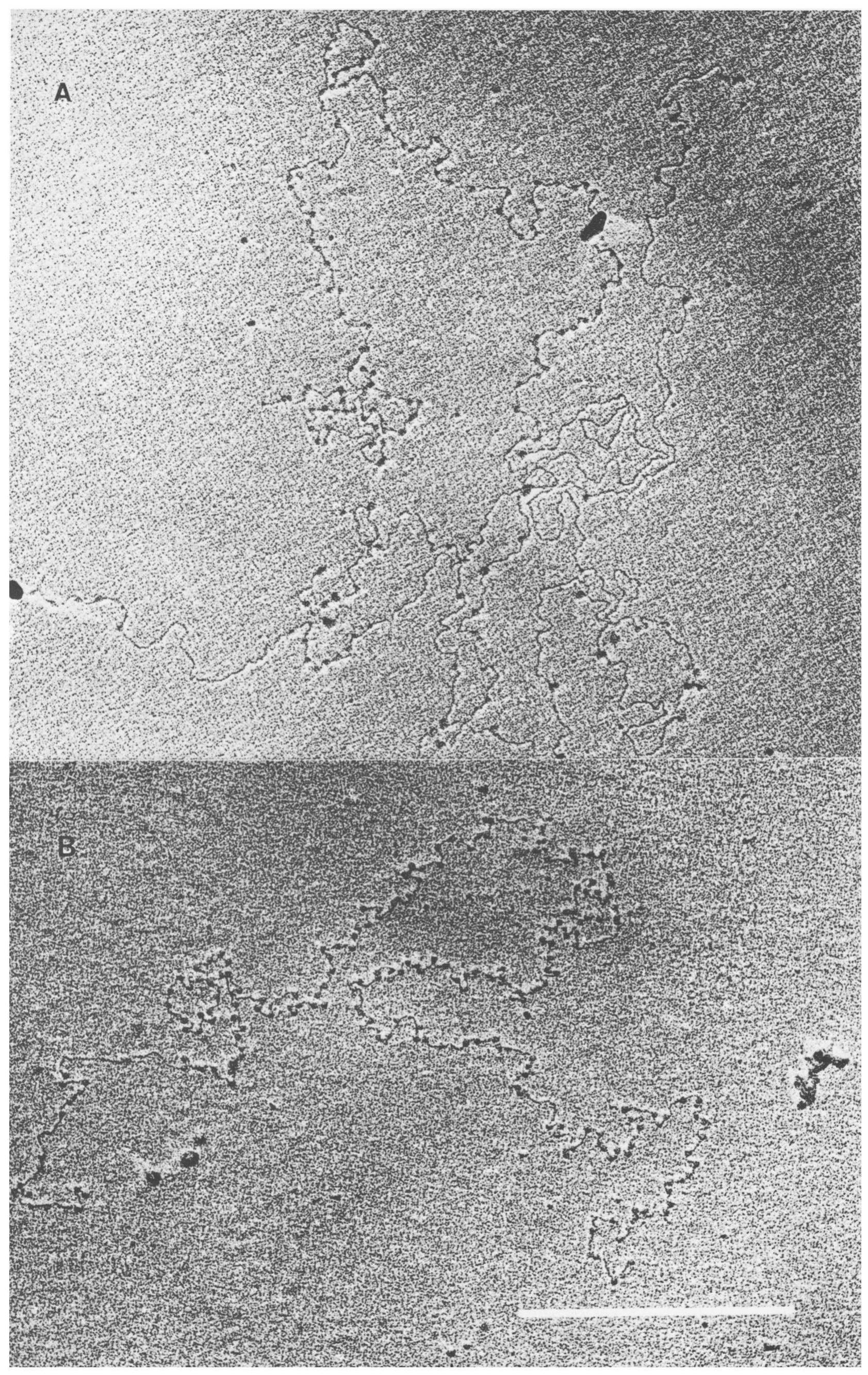 A and b. electron micrographs of chicken liver chromatin