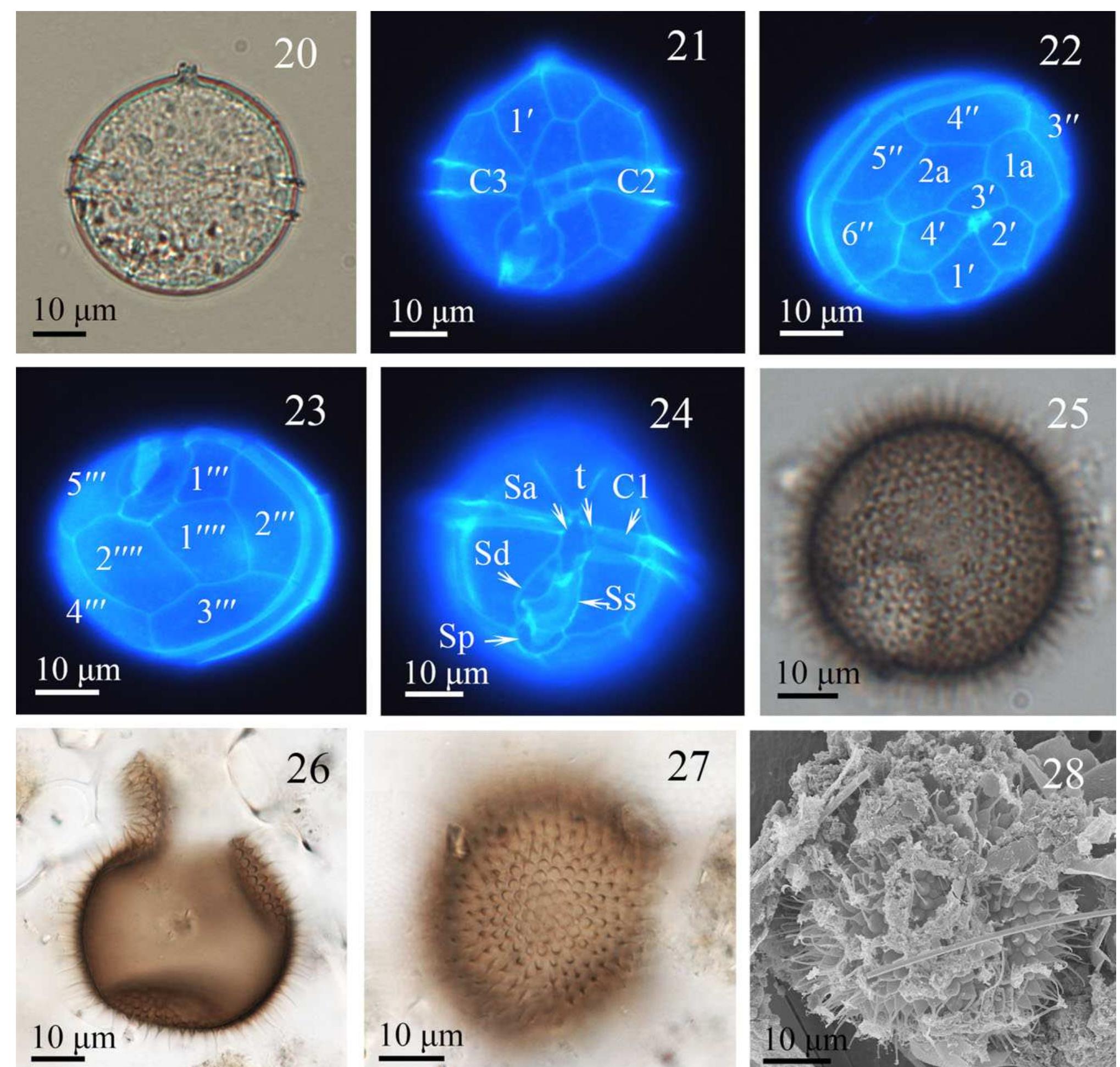 S 20-28. motile cells and cysts of archaeperidinium