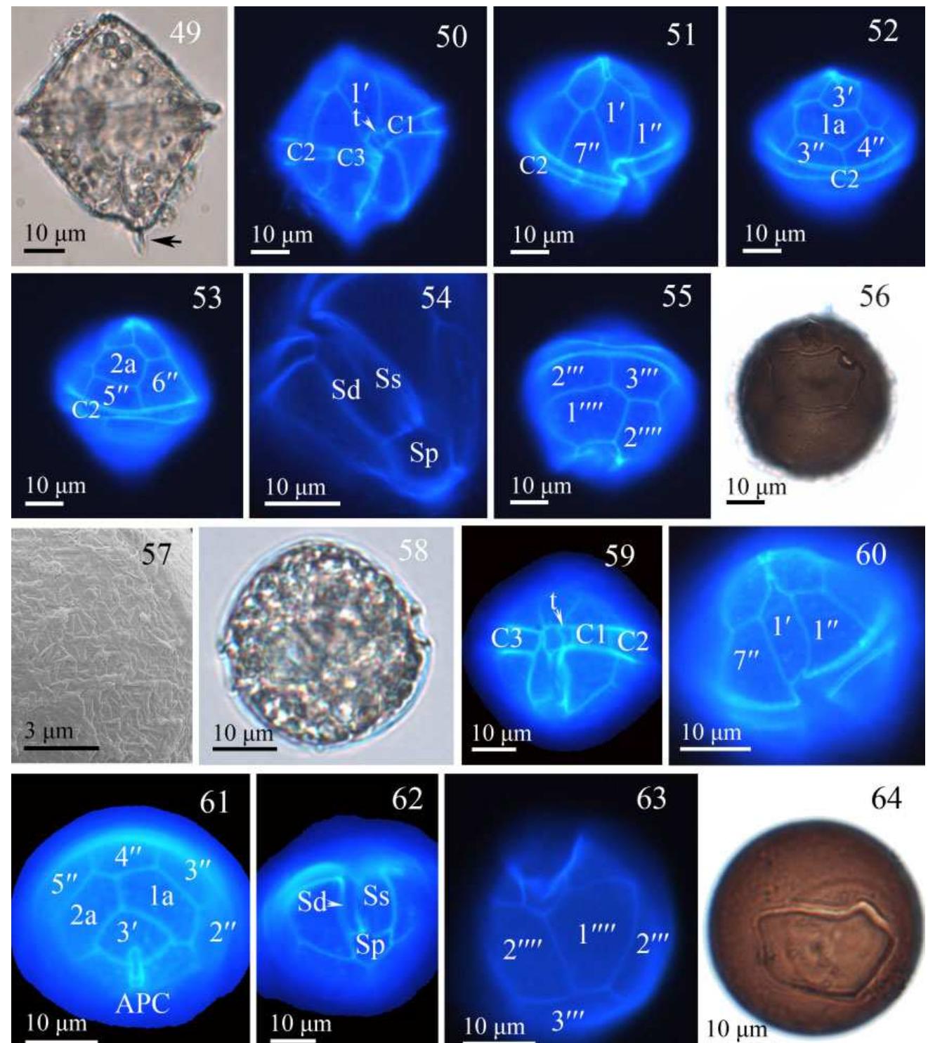 S 49-64. motile cells and cysts of protoperidinium abel var.