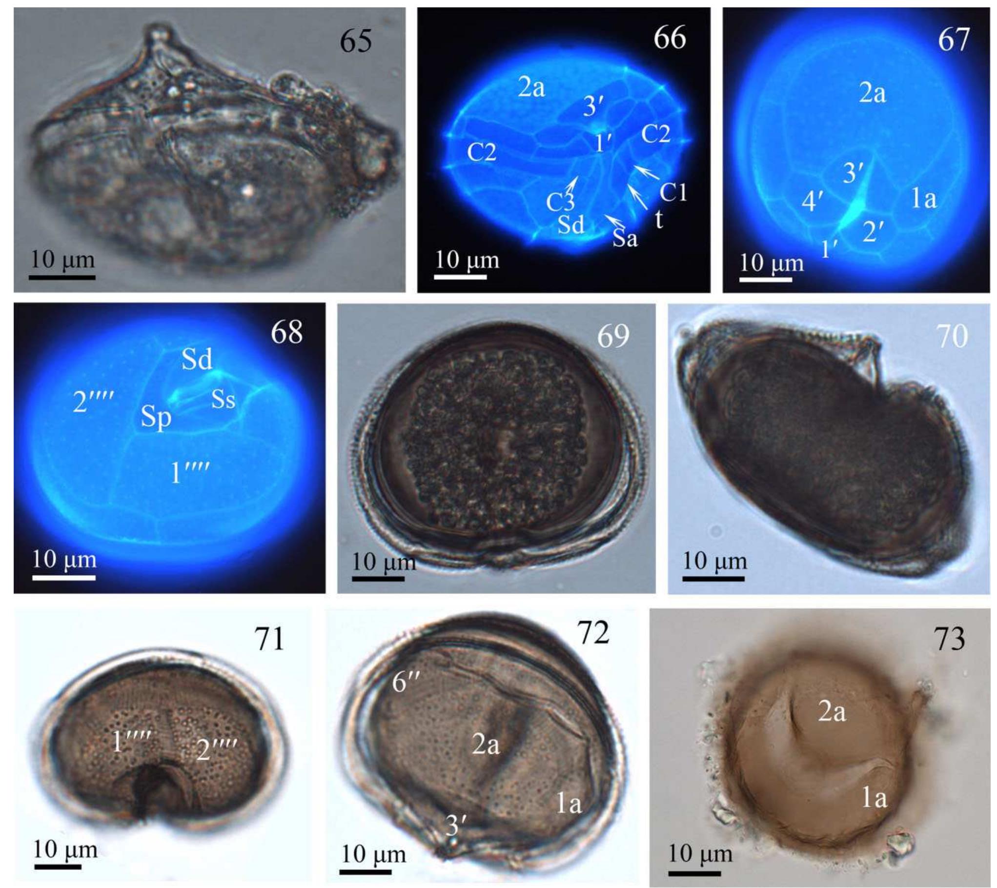 S 65-73. motile cells and empty cysts of protoperidinium