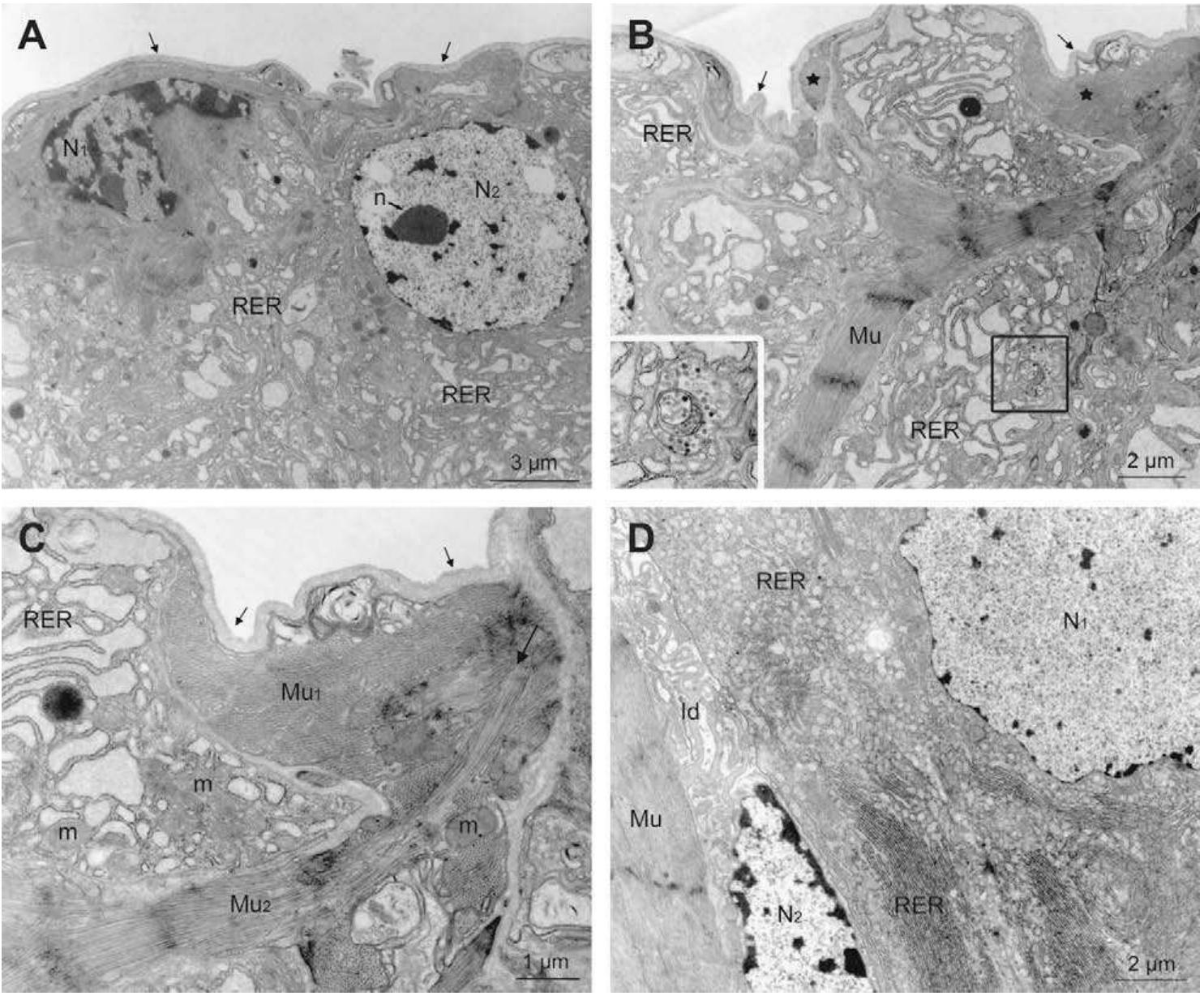 Transmission electron microscopy (a) basal region of the