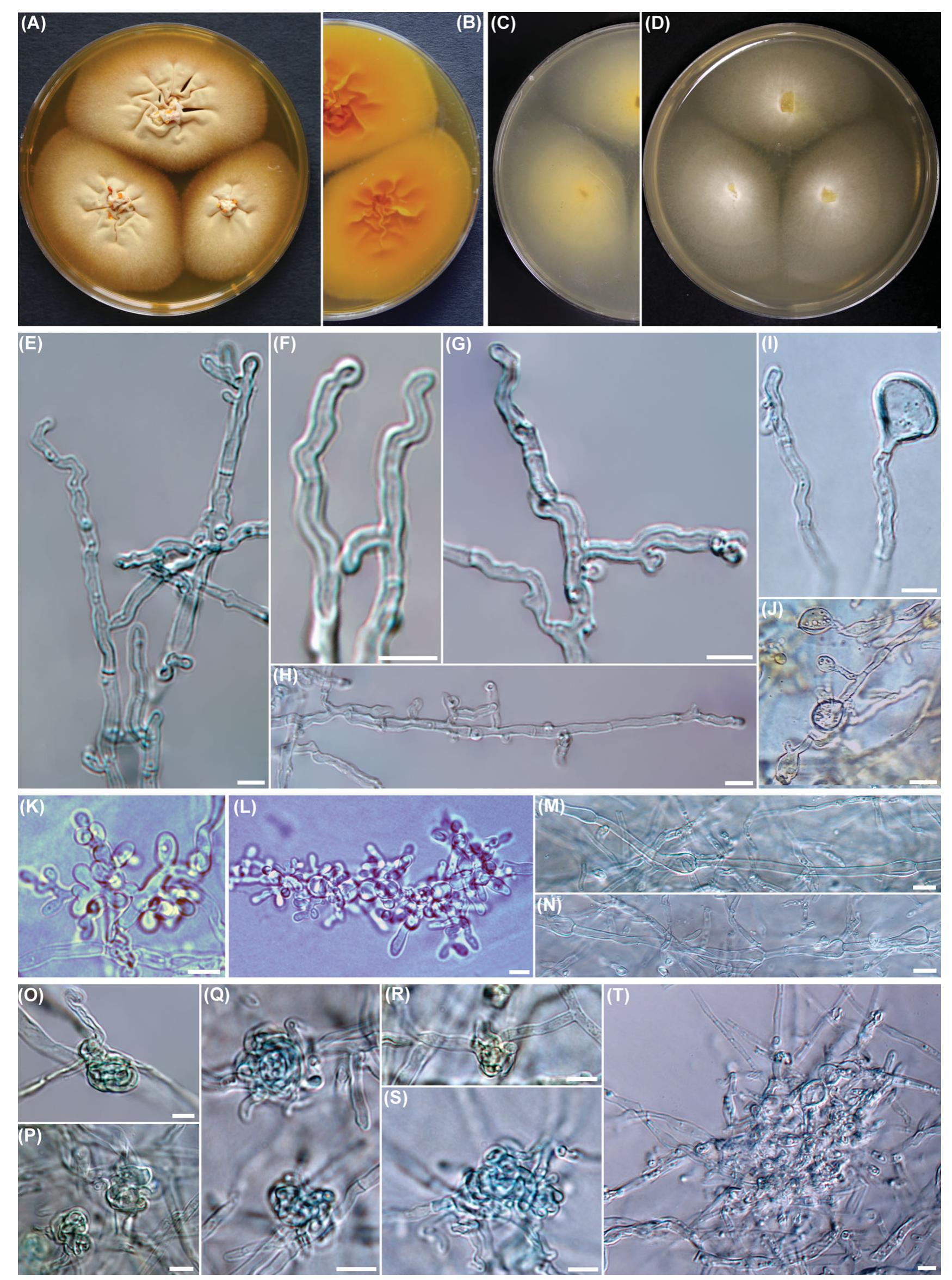 Microsporum aenigmaticum ccf 4608" (culture collection of