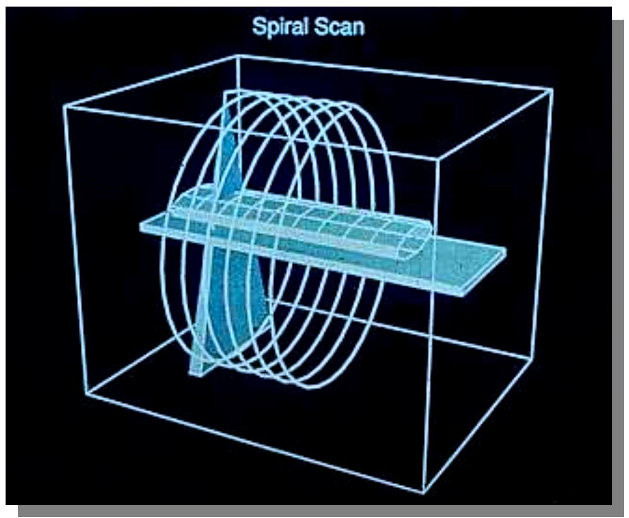 Schematic of tomotherapy's fan beam geometry and helica