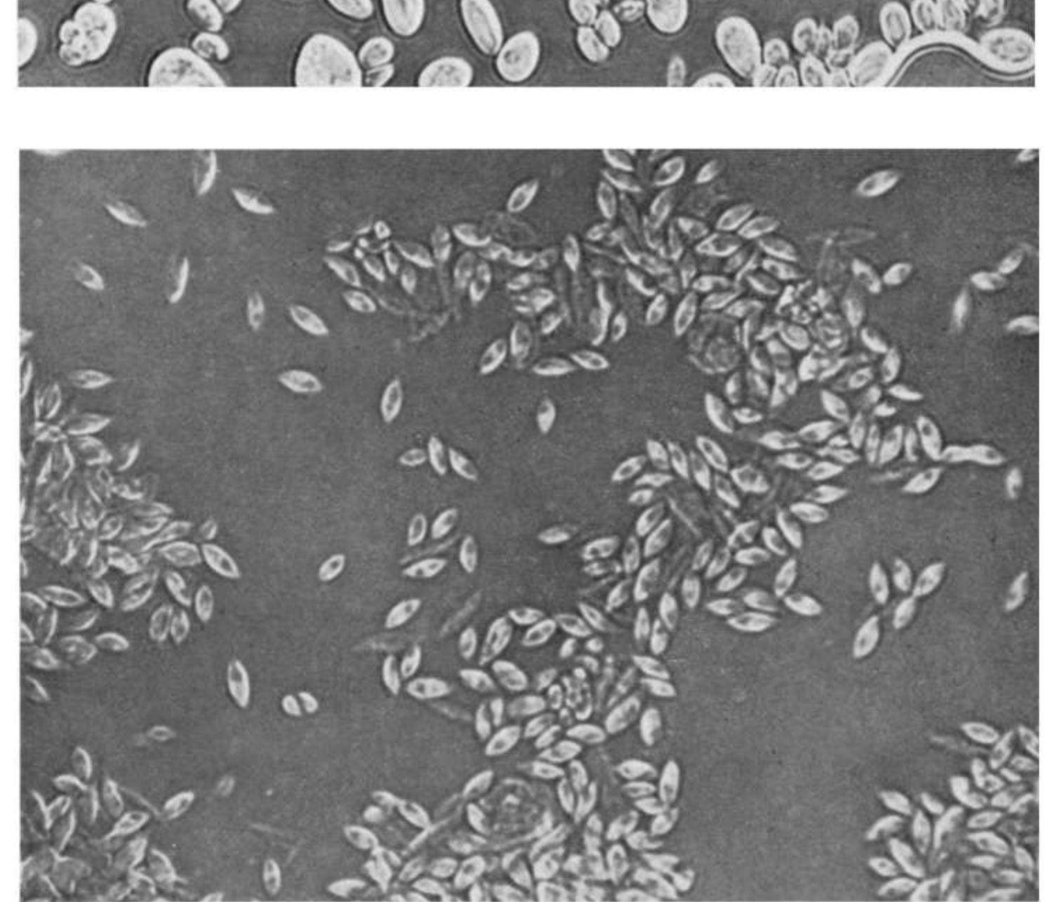 The appearance of newly isolated green alga (scenedesmus