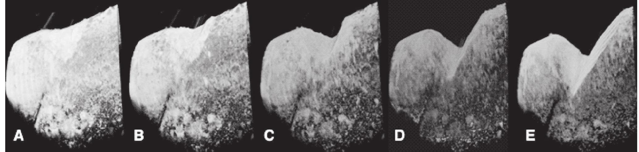 Figure 4 - from Optical Coherence Tomography for